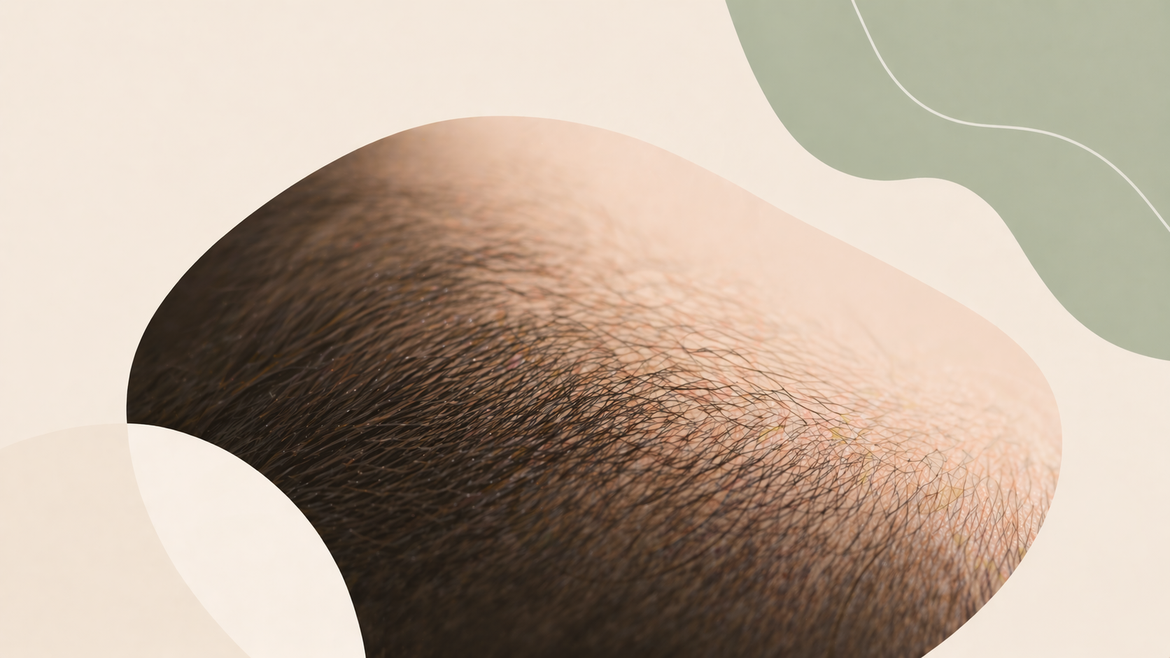 My Hair Is So Thin I Can See My Scalp: Causes & Solutions