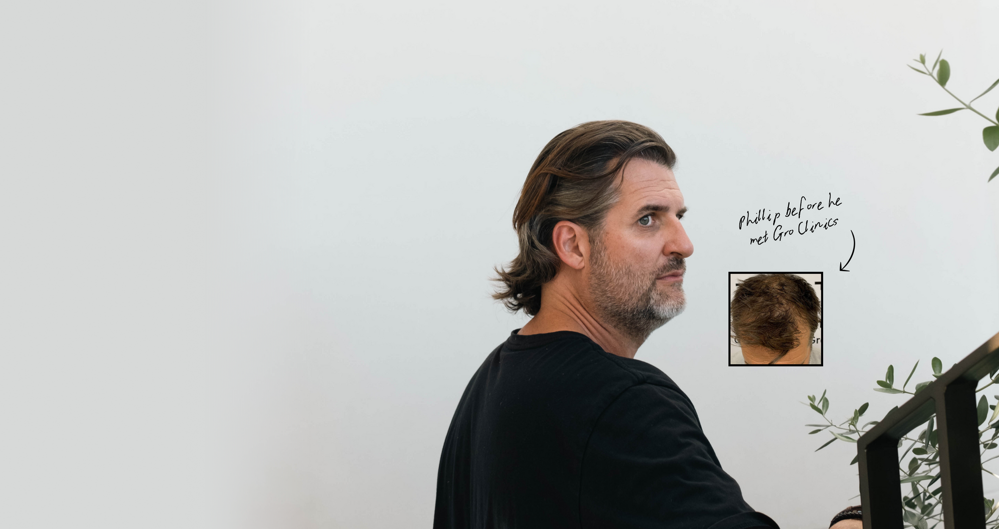 Gro: The Hair Growth Experts - Complete Hair Growth Solutions